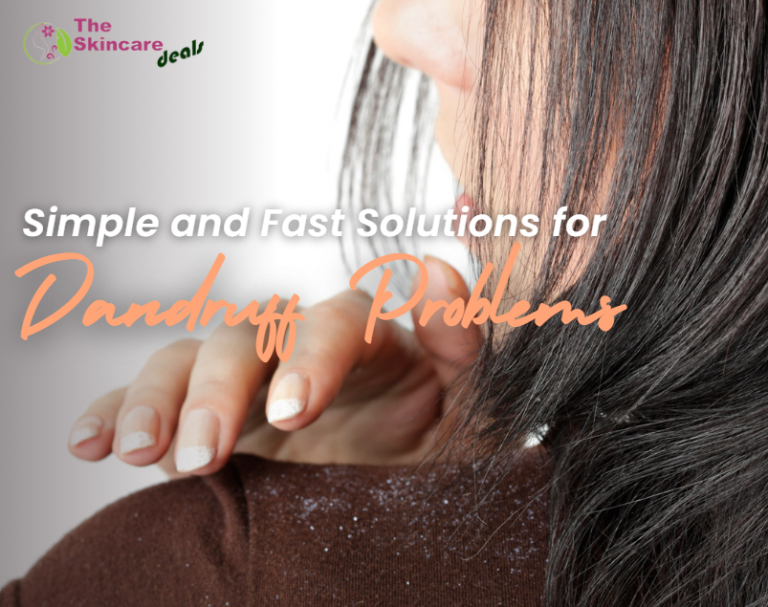 Simple and Fast Solutions for Dandruff Problems - The Skin Care Deals