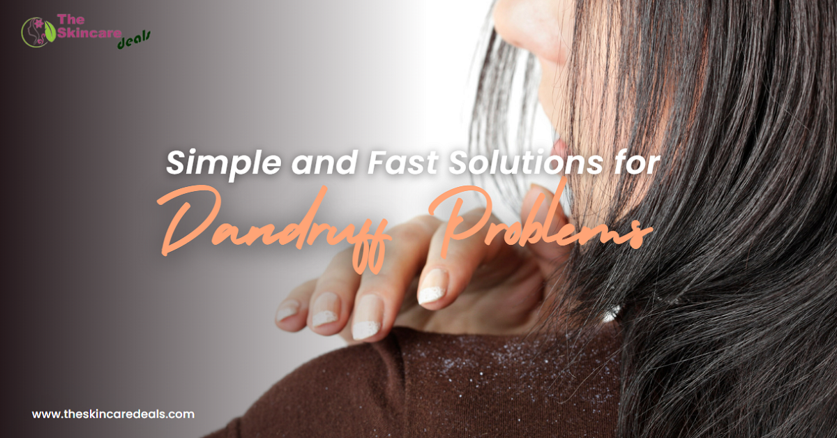 Simple and Fast Solutions for Dandruff Problems - The Skin Care Deals
